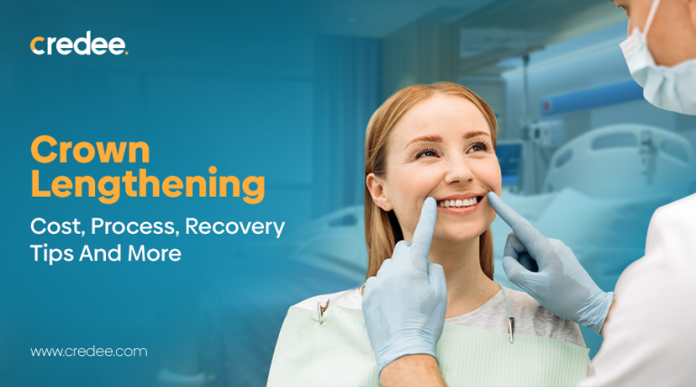 Crown Lengthening Guide 2025: Cost and Procedure | Credee
