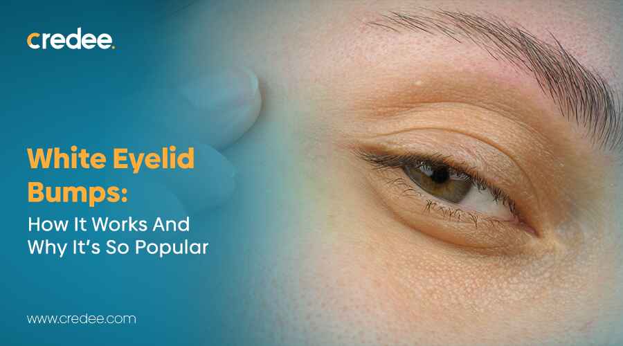 White Bump on Lash Line: Causes, Treatment, Not a Stye